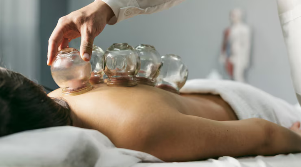 Benefits of Cupping Therapy for Pain Relief and Wellness
