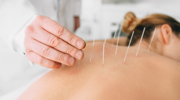 Acupuncture for Post-Surgical Recovery: What to Expect