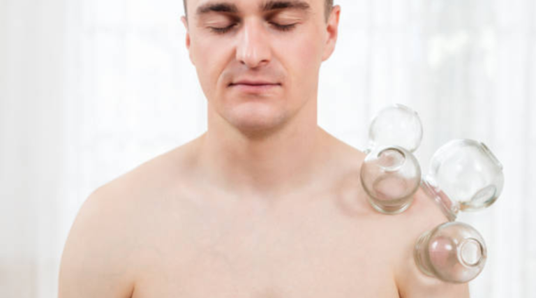 How Cupping Therapy Supports Respiratory Health